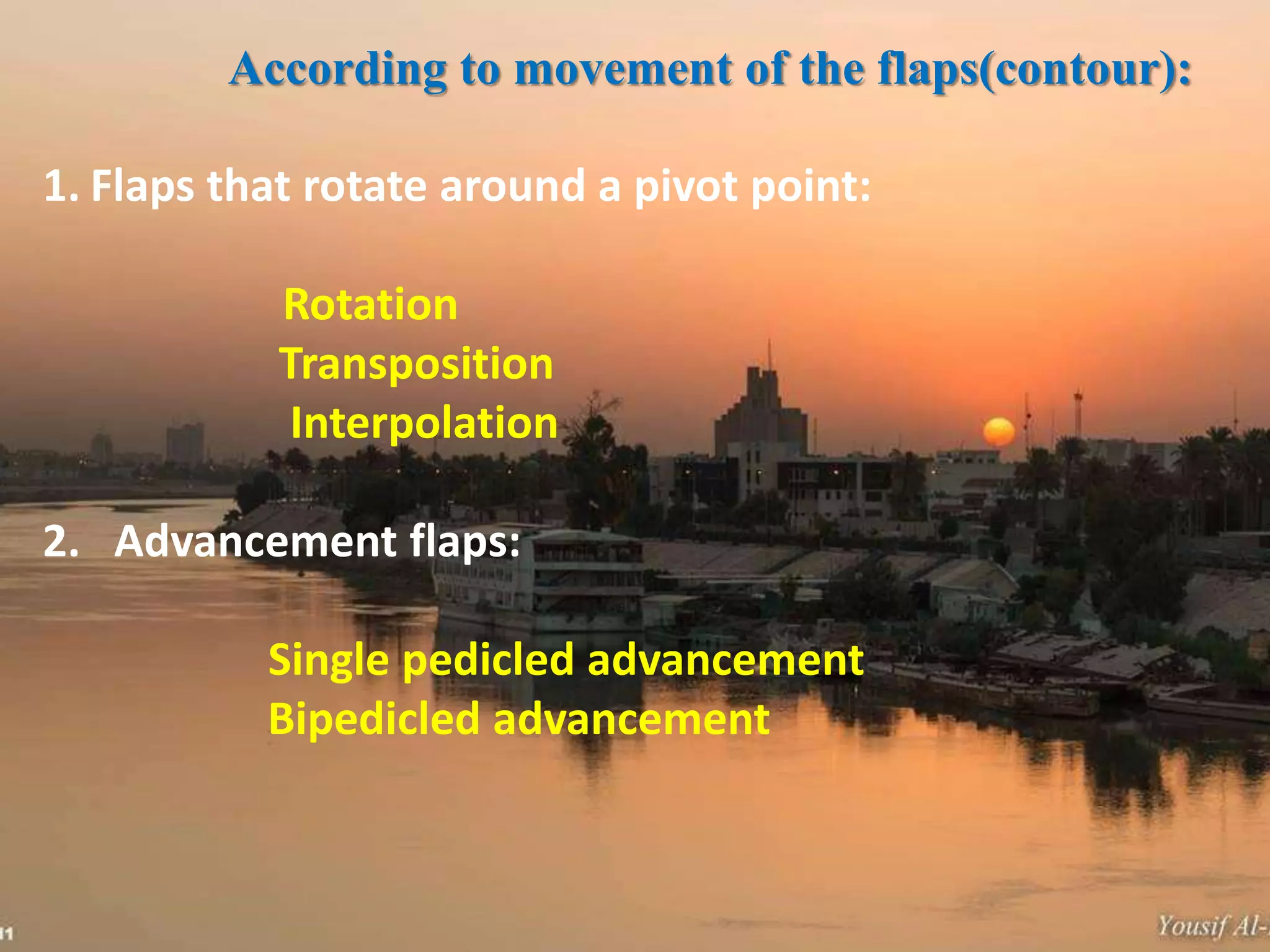 Basic principles of flaps | PPSX