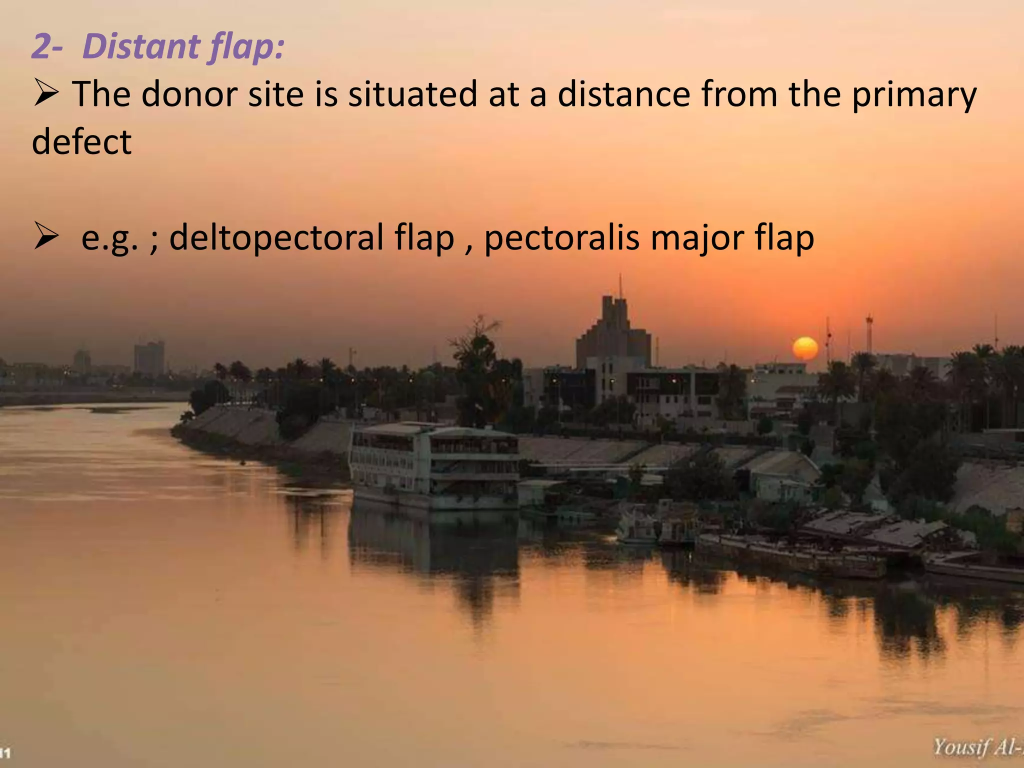 Basic principles of flaps | PPSX | Skin and Dermatology | Diseases and ...