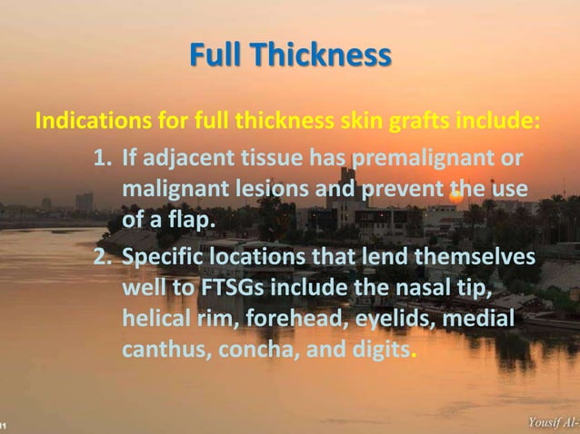 Basic principles of flaps | PPSX | Skin and Dermatology | Diseases and ...