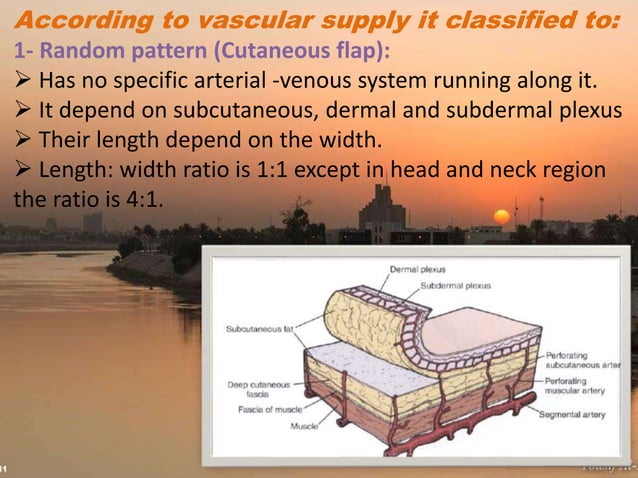 Basic principles of flaps | PPSX | Skin and Dermatology | Diseases and ...