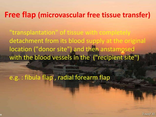 Basic principles of flaps | PPSX | Skin and Dermatology | Diseases and ...