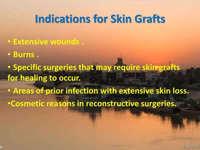 Basic principles of flaps | PPSX | Skin and Dermatology | Diseases and ...