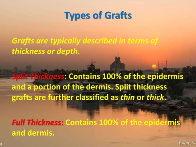 Basic principles of flaps | PPSX | Skin and Dermatology | Diseases and ...