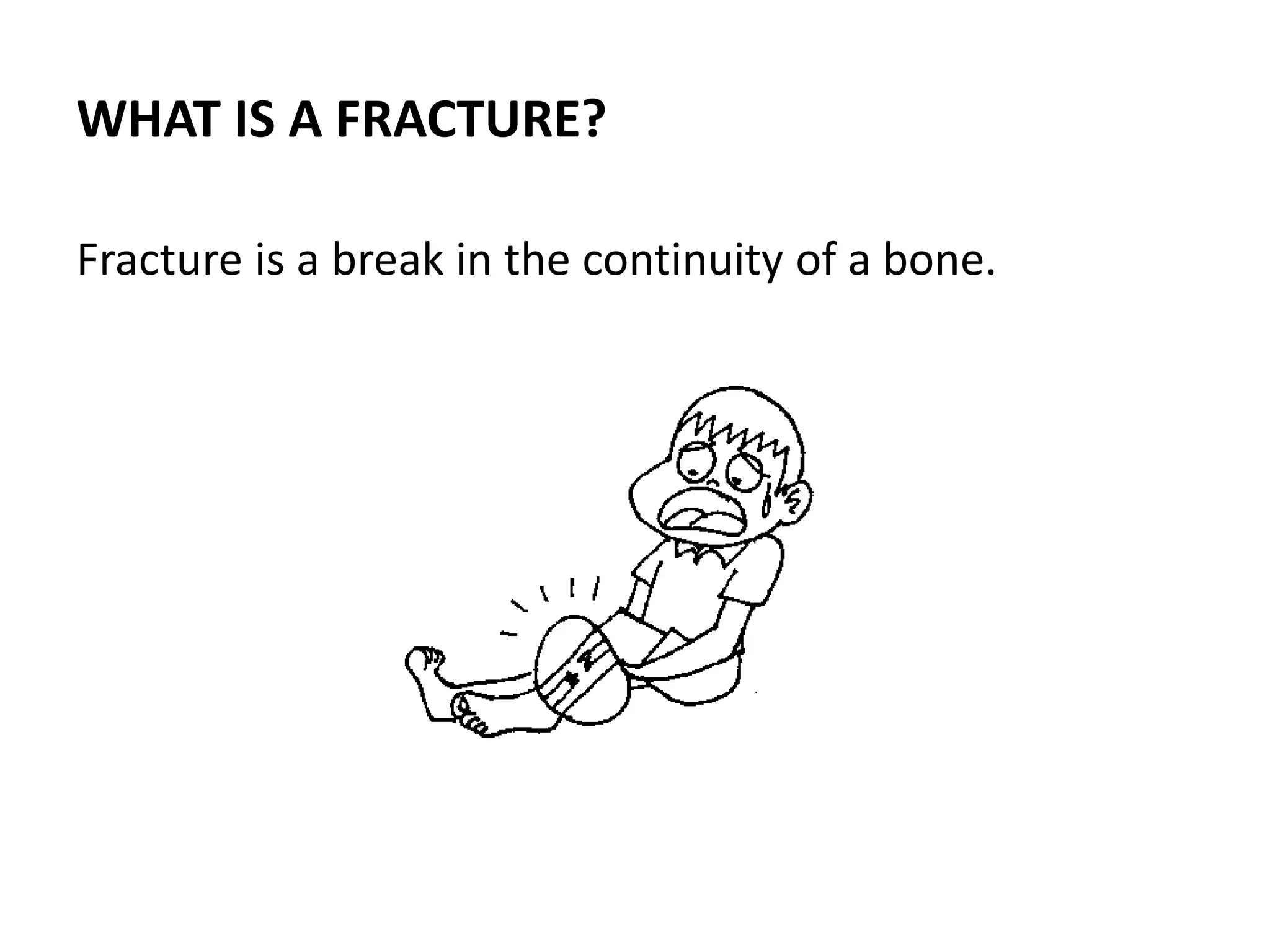 Basic Principles of Fracture Management | PDF