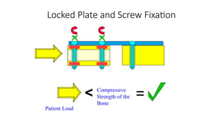 Basic Principles of Internal Fixationc.pptx