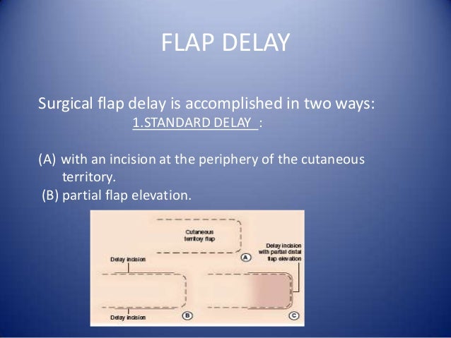 Basic Principles Of Local Flap In Plastic Surgery