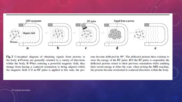 Basic principles of magnetic resonance imaging for beginner - Dr ...