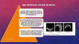 Basic principles of magnetic resonance imaging for beginner - Dr ...