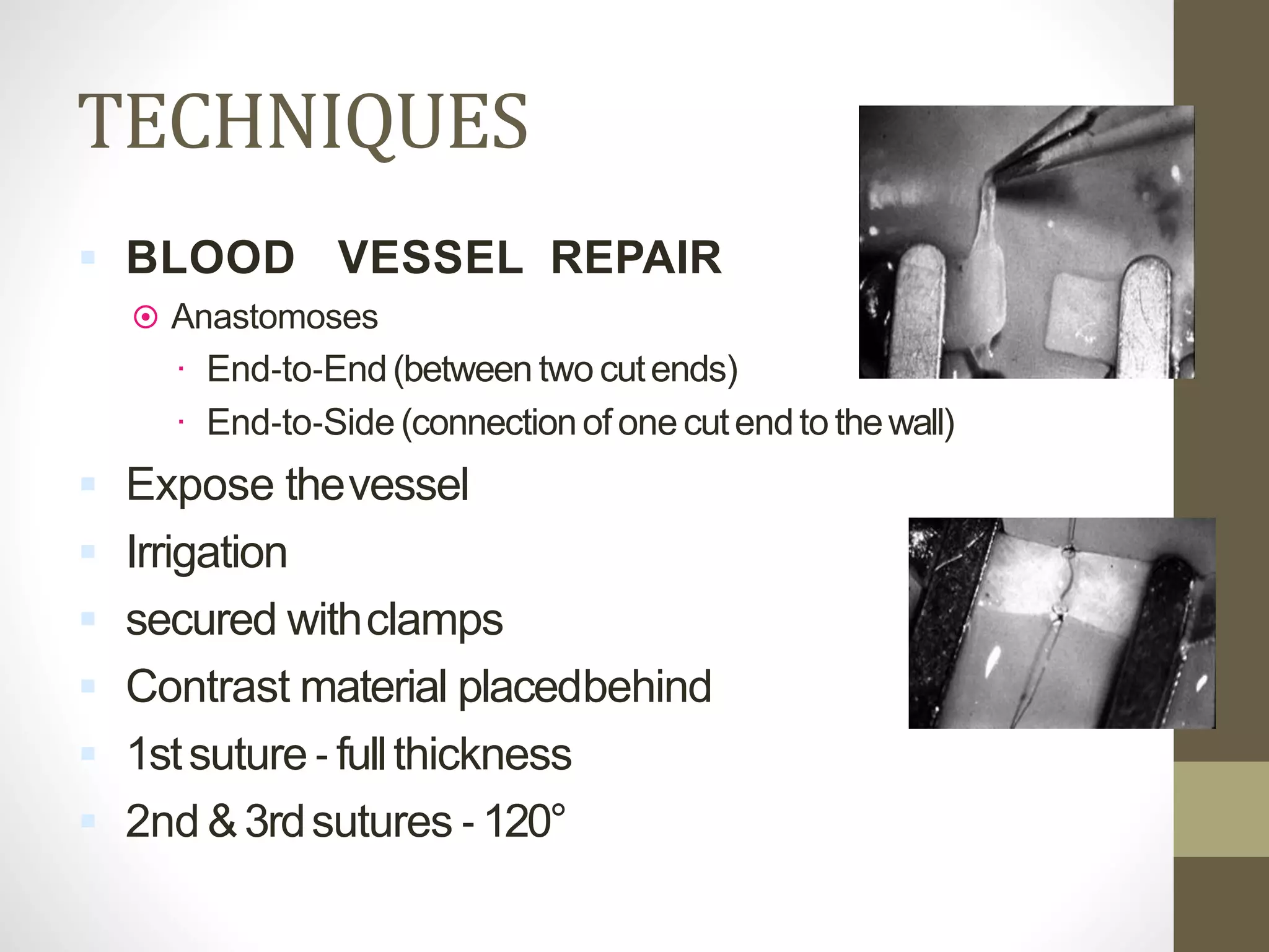 Basic principles of microsurgery | PPTX
