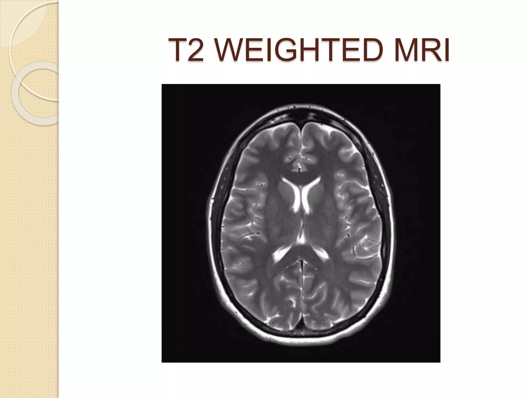 Basic principles of mri | PPTX