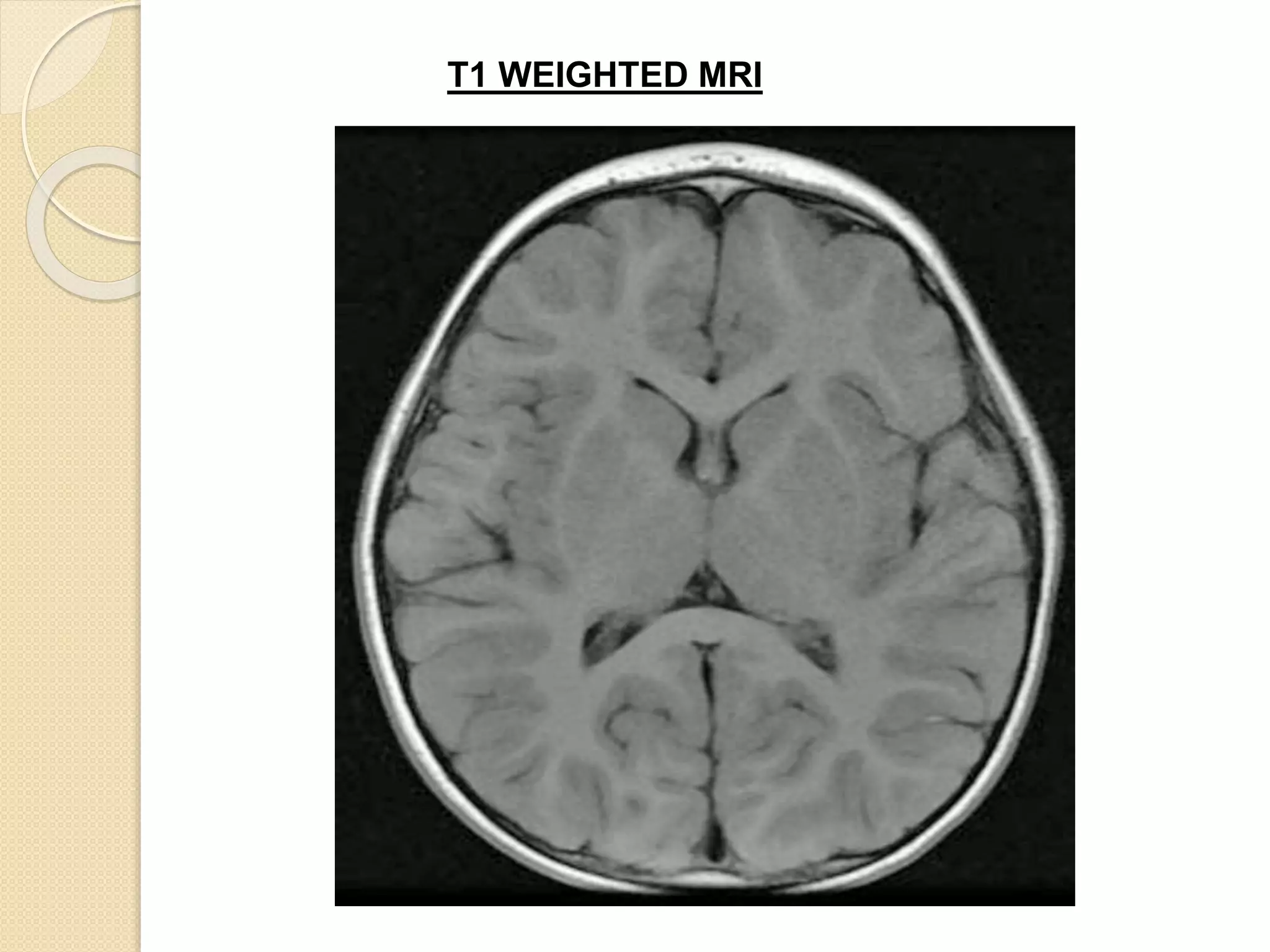 Basic principles of mri | PPTX