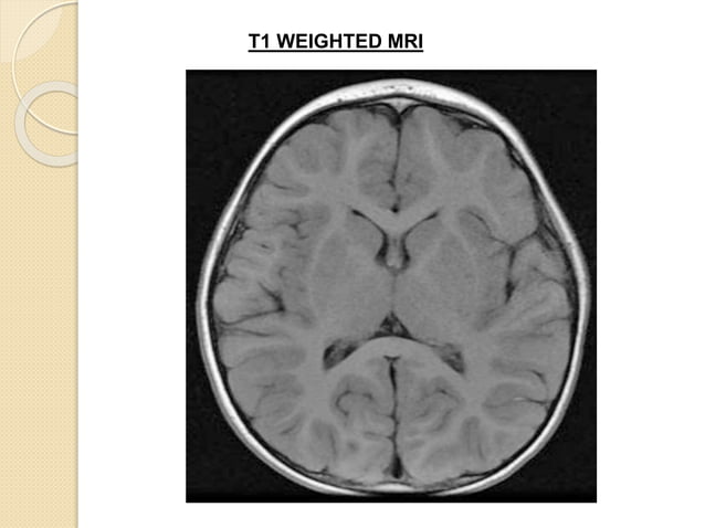 Basic principles of mri | PPTX | Chemistry | Science