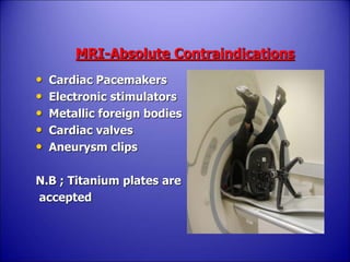BASIC PRINCIPLES OF MRI Galala.pptx