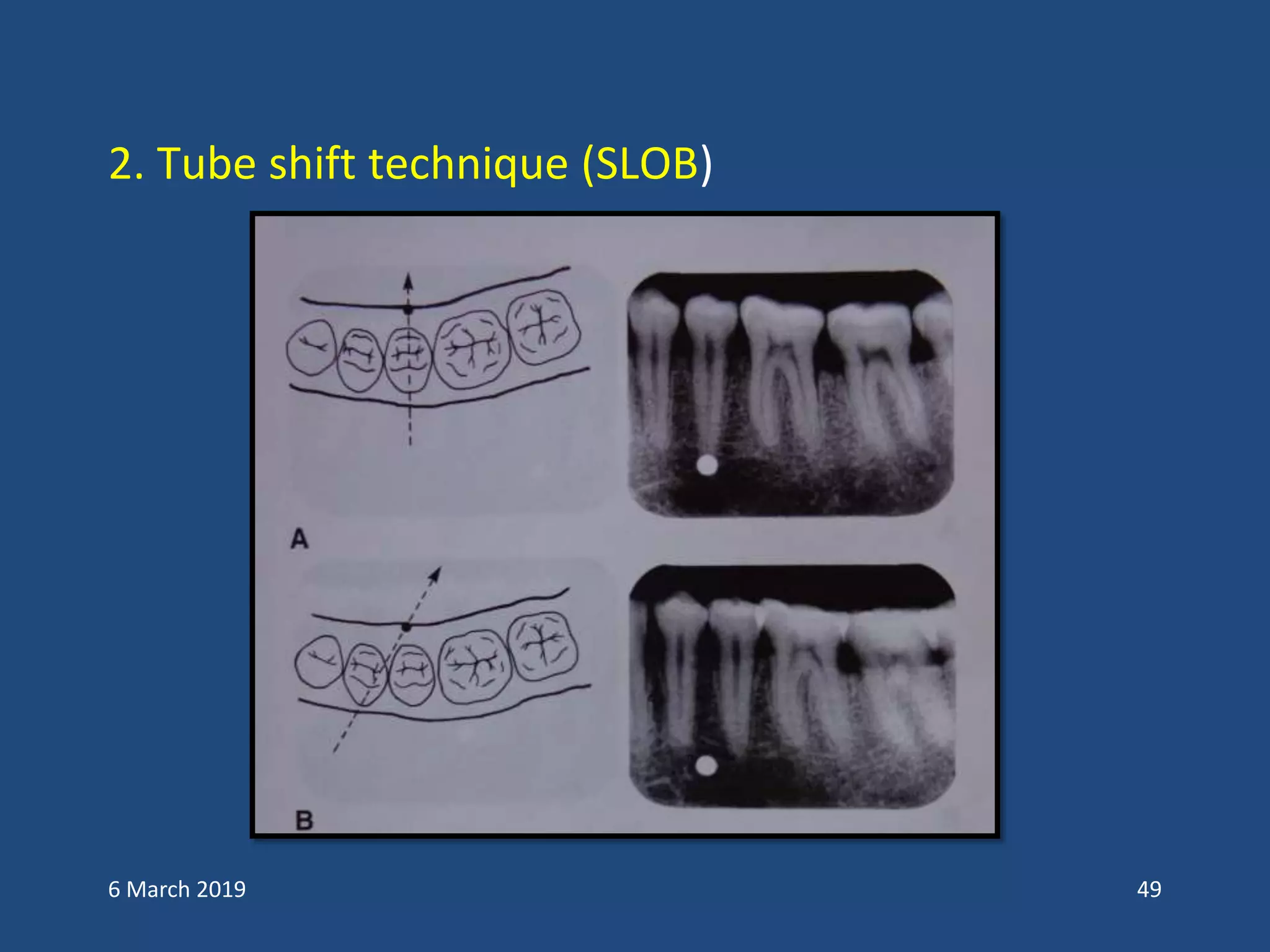 Basic principles of oral and maxillofacial surgery | PPTX