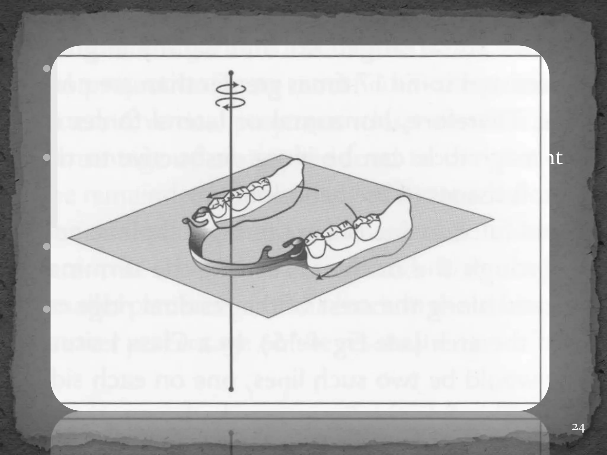 Basic principles of removable partial denture design copy | PPTX
