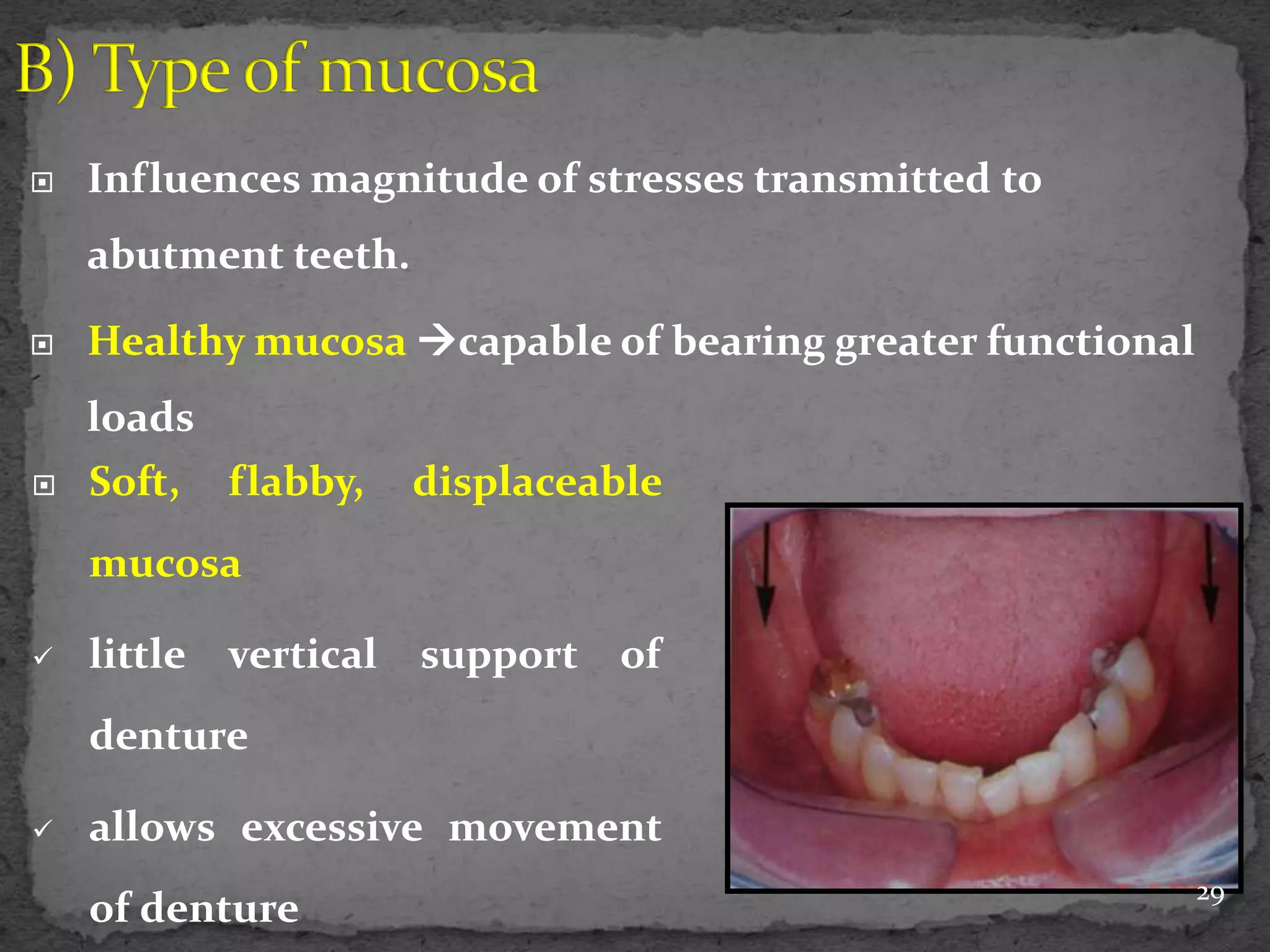 Basic principles of removable partial denture design copy | PPTX