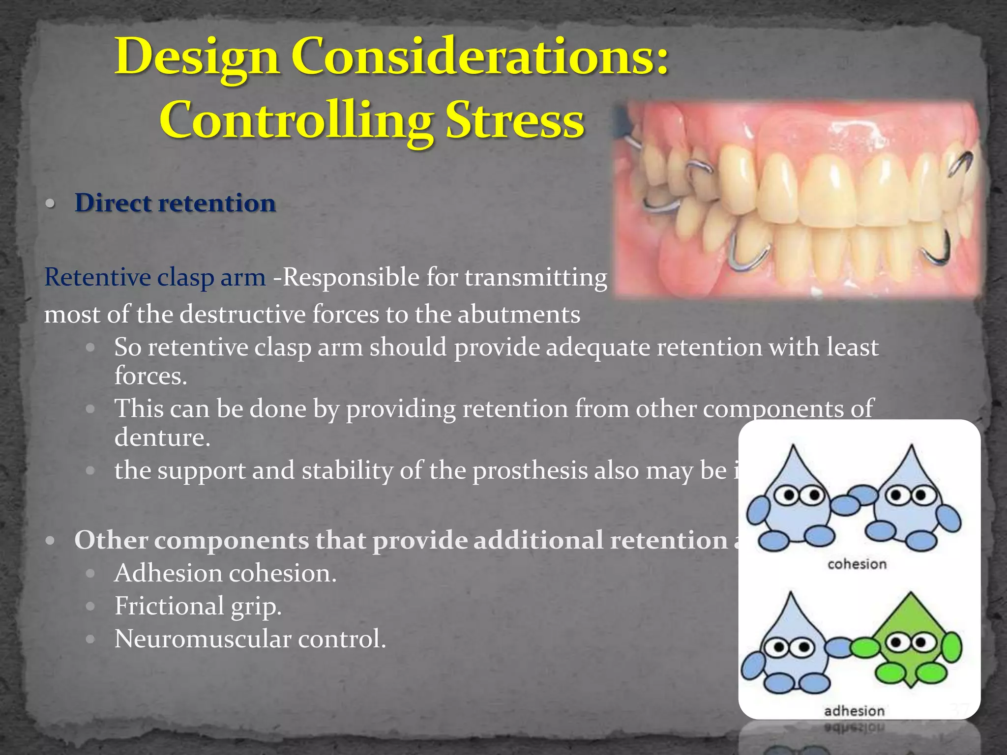 Basic principles of removable partial denture design copy | PPTX