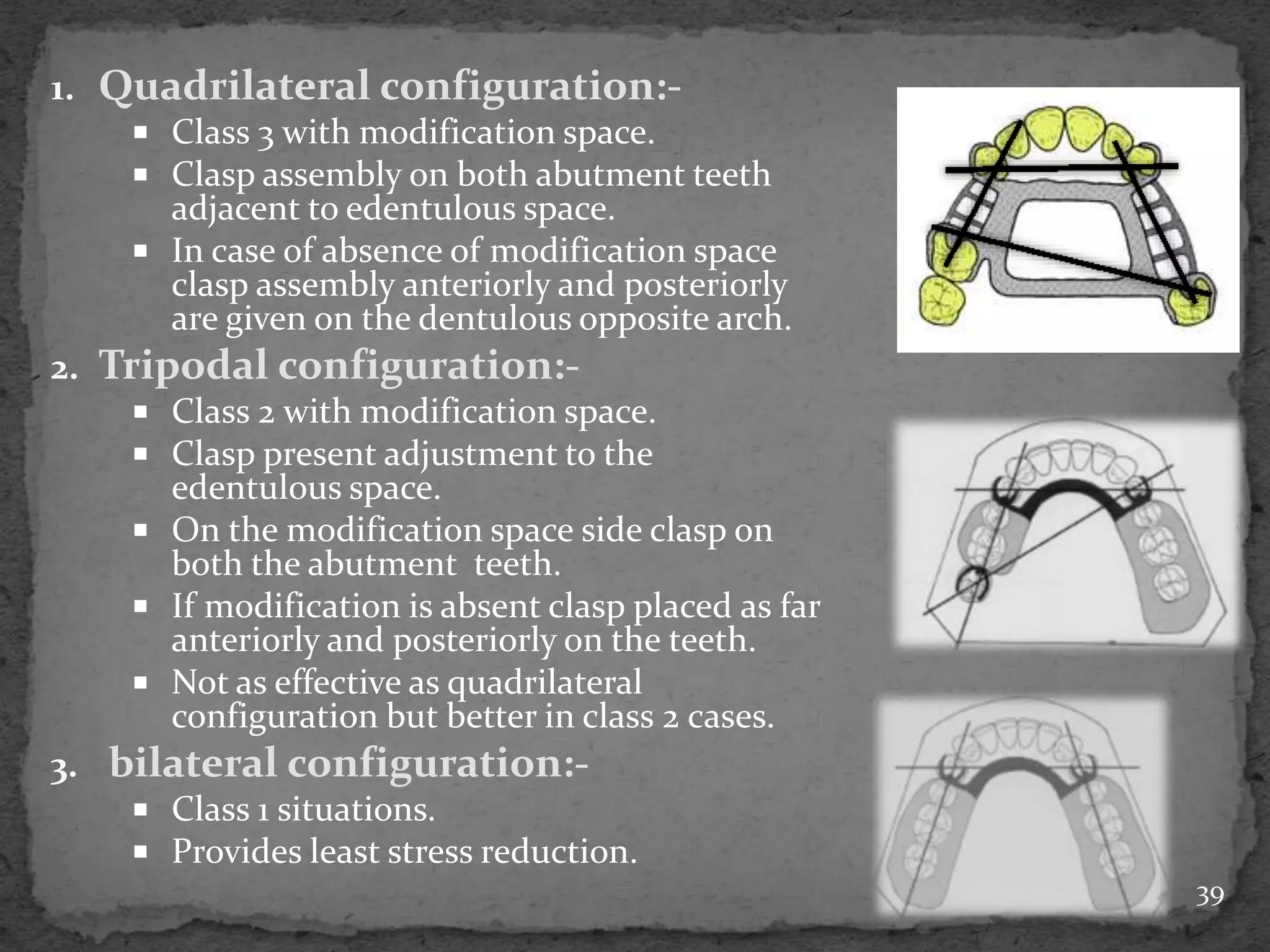 Basic principles of removable partial denture design copy | PPTX