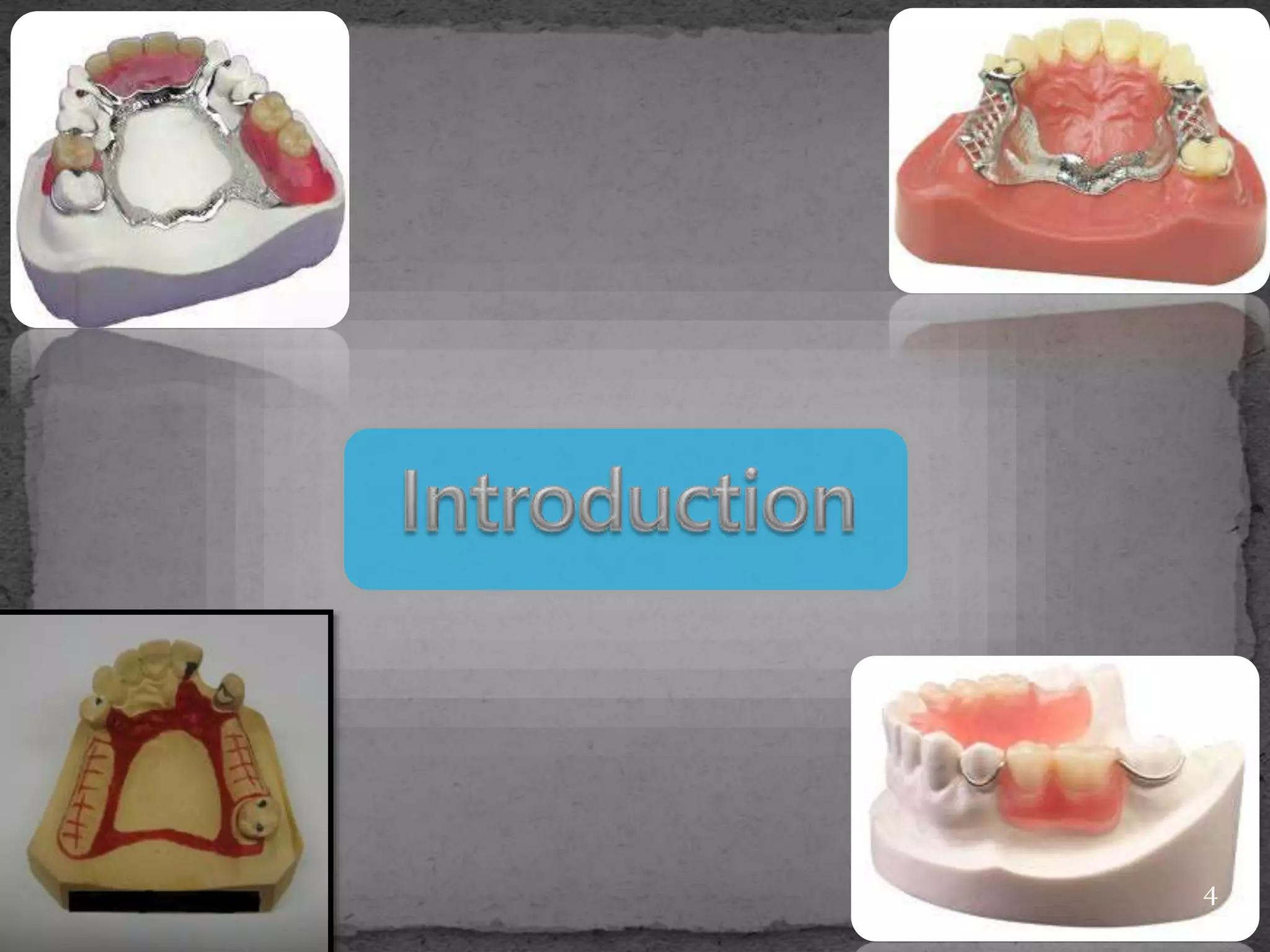 Basic principles of removable partial denture design copy | PPTX