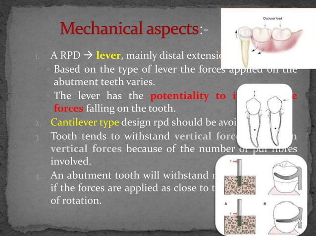 Basic principles of removable partial denture design copy | PPTX ...
