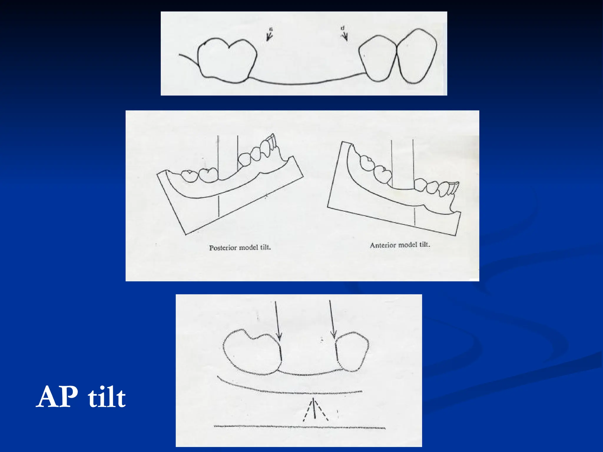 basic_principles_of_removable_partial_denture_design_-_copy.ppt