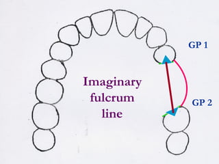 basic_principles_of_removable_partial_denture_design_-_copy.ppt