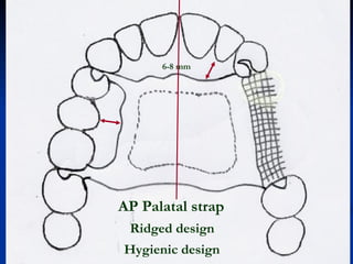 basic_principles_of_removable_partial_denture_design_-_copy.ppt