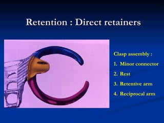 basic_principles_of_removable_partial_denture_design_-_copy.ppt