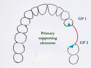 basic_principles_of_removable_partial_denture_design_-_copy.ppt