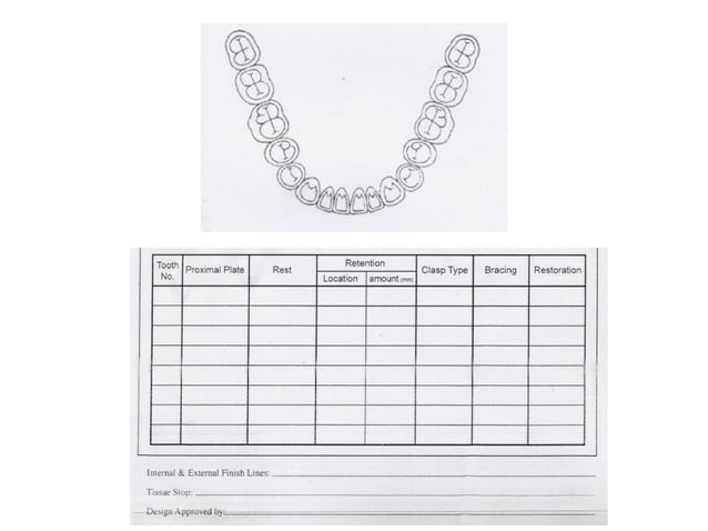 Basic Principles of RPD design I & II.pdf