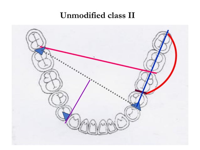 Basic Principles of RPD design I & II.pdf