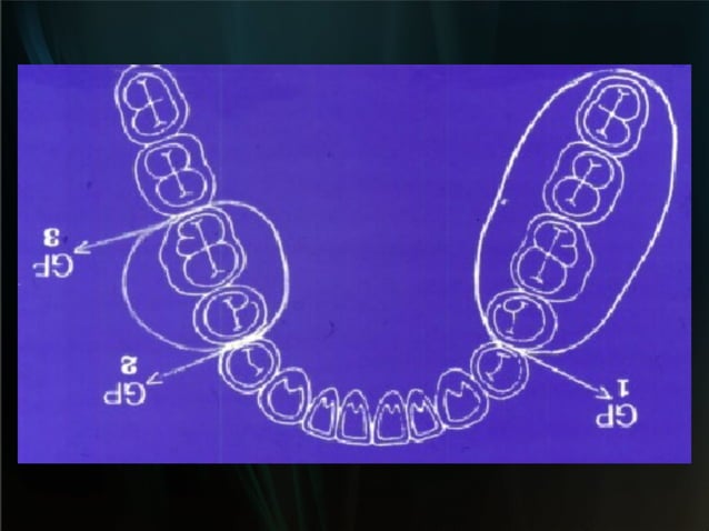 Basic Principles of RPD design I & II.pdf