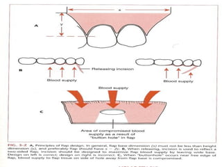 Basic principles of surgery | PPT