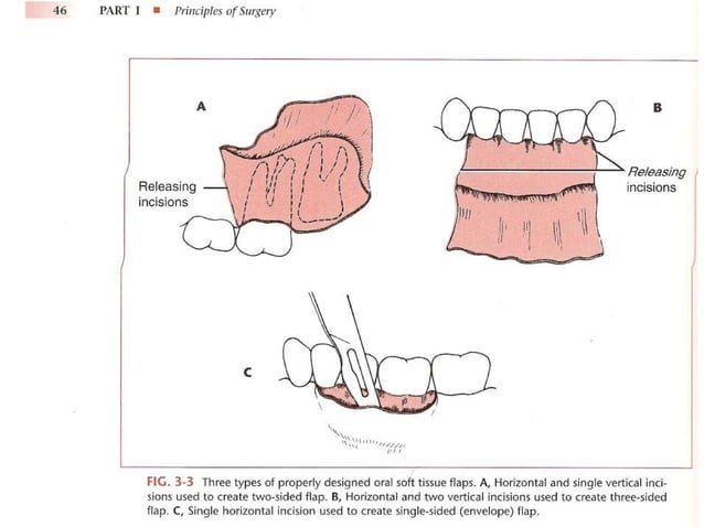 Basic principles of surgery | PPT | Surgery | Medical Health