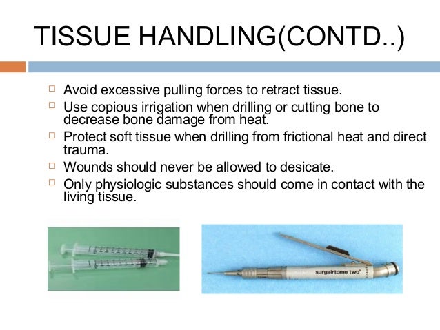 Basic principles of surgery