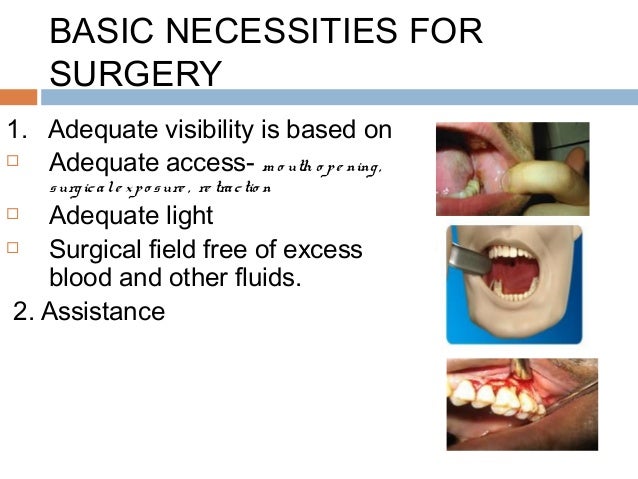 Basic principles of surgery