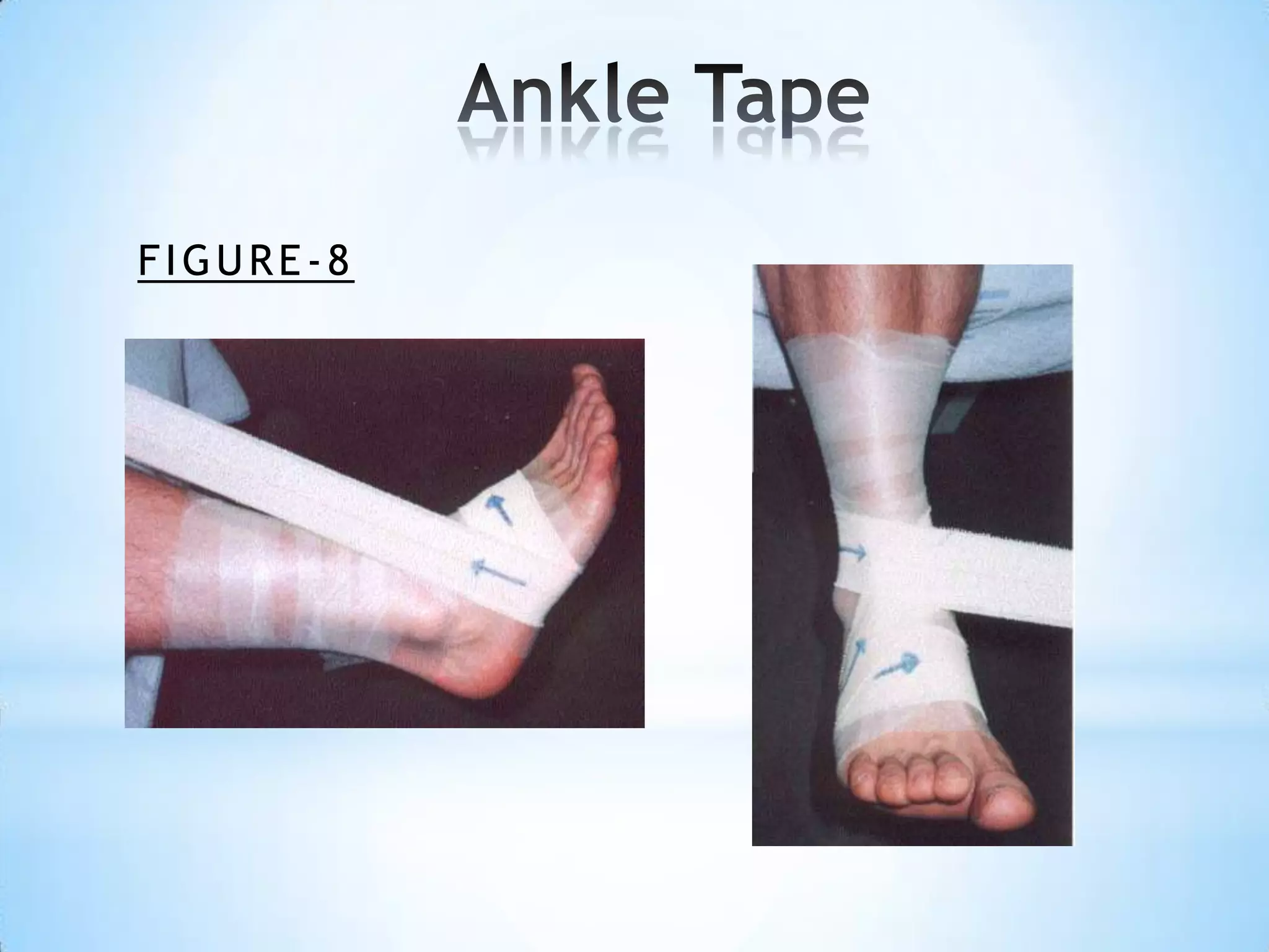 Basic principles of taping techniques - Mr. Marc Lievens | PPTX