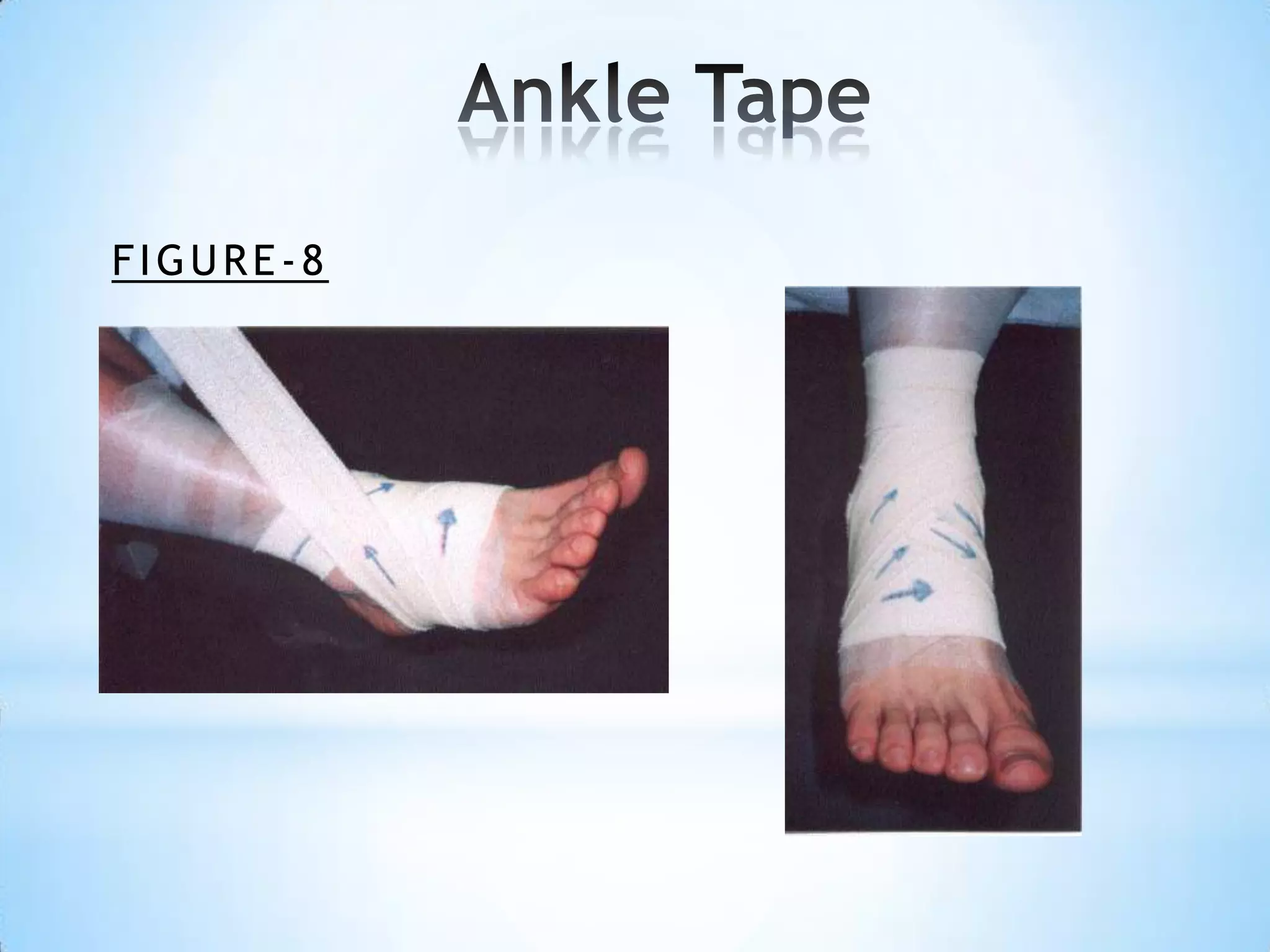 Basic principles of taping techniques - Mr. Marc Lievens | PPTX