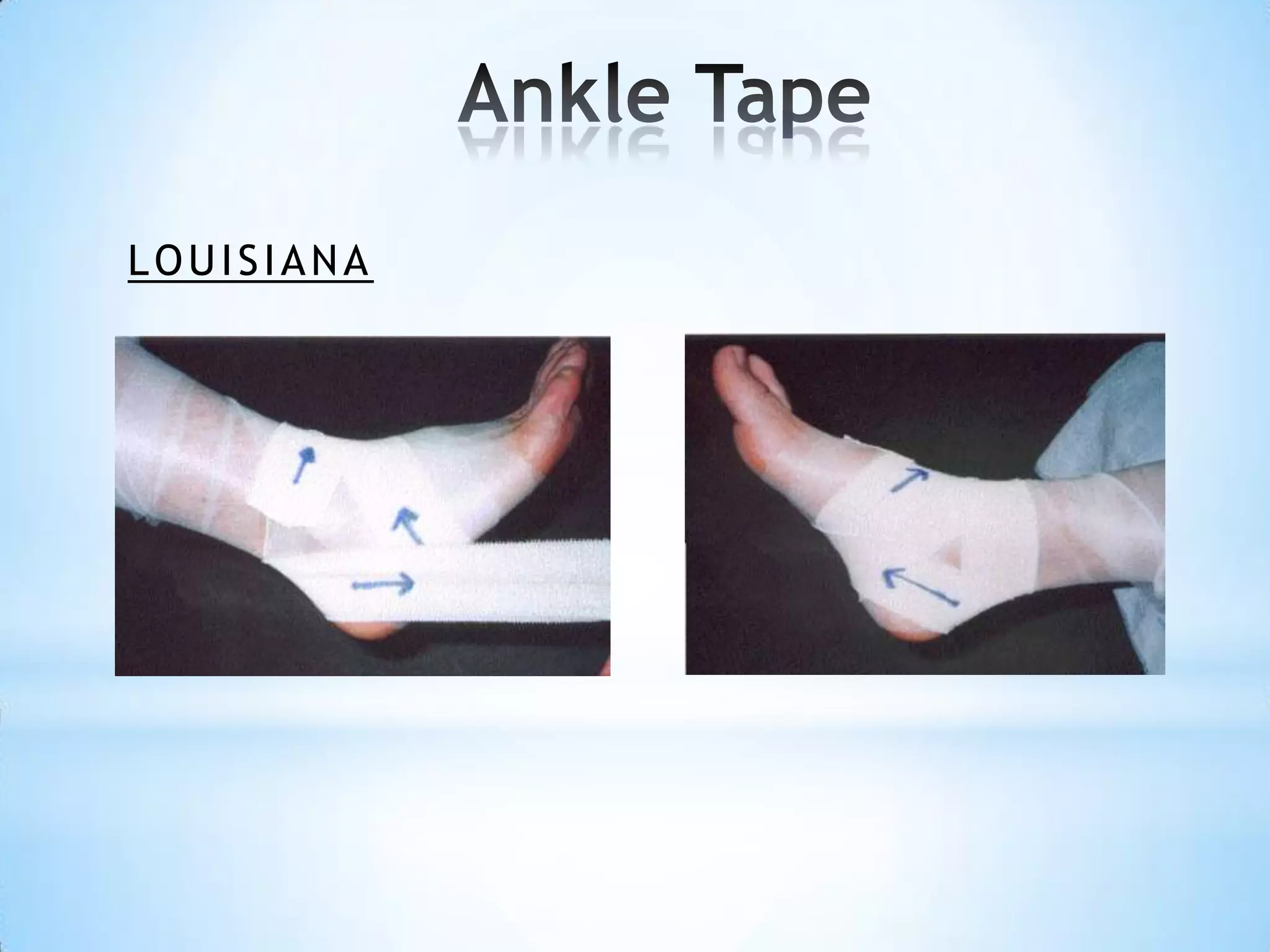 Basic principles of taping techniques - Mr. Marc Lievens | PPTX