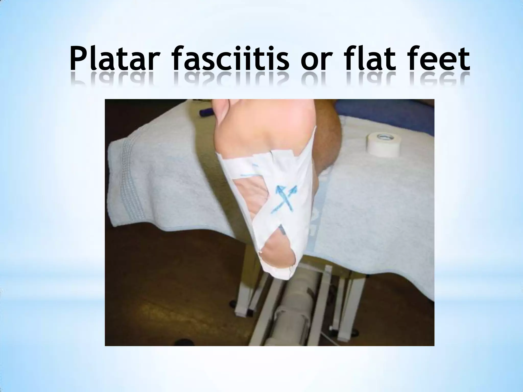 Basic principles of taping techniques - Mr. Marc Lievens | PPTX