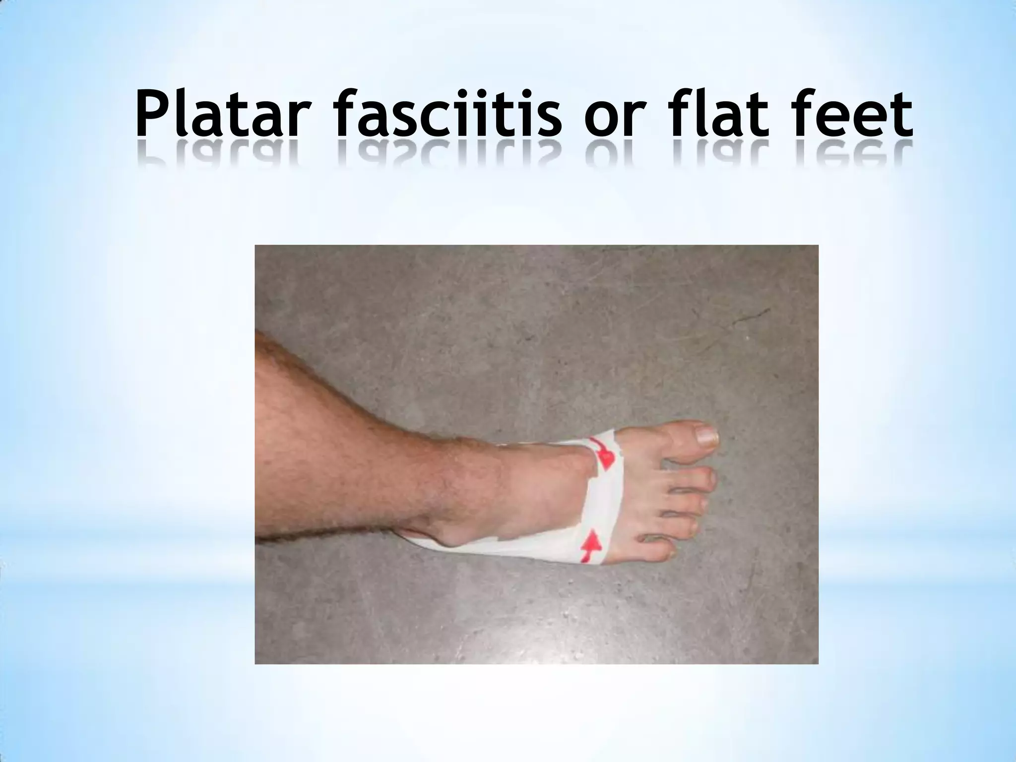 Basic principles of taping techniques - Mr. Marc Lievens | PPTX