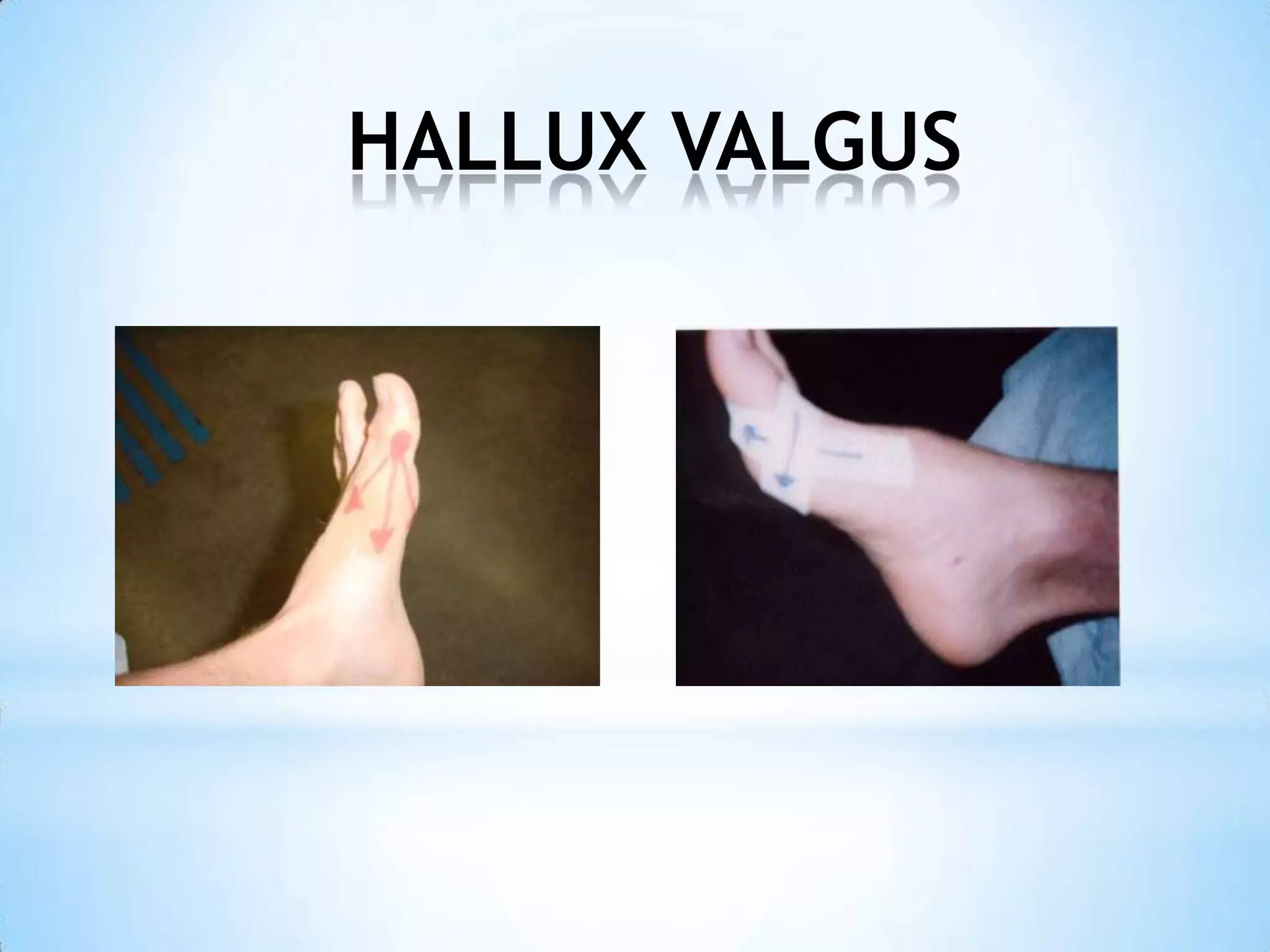 Basic principles of taping techniques - Mr. Marc Lievens | PPTX