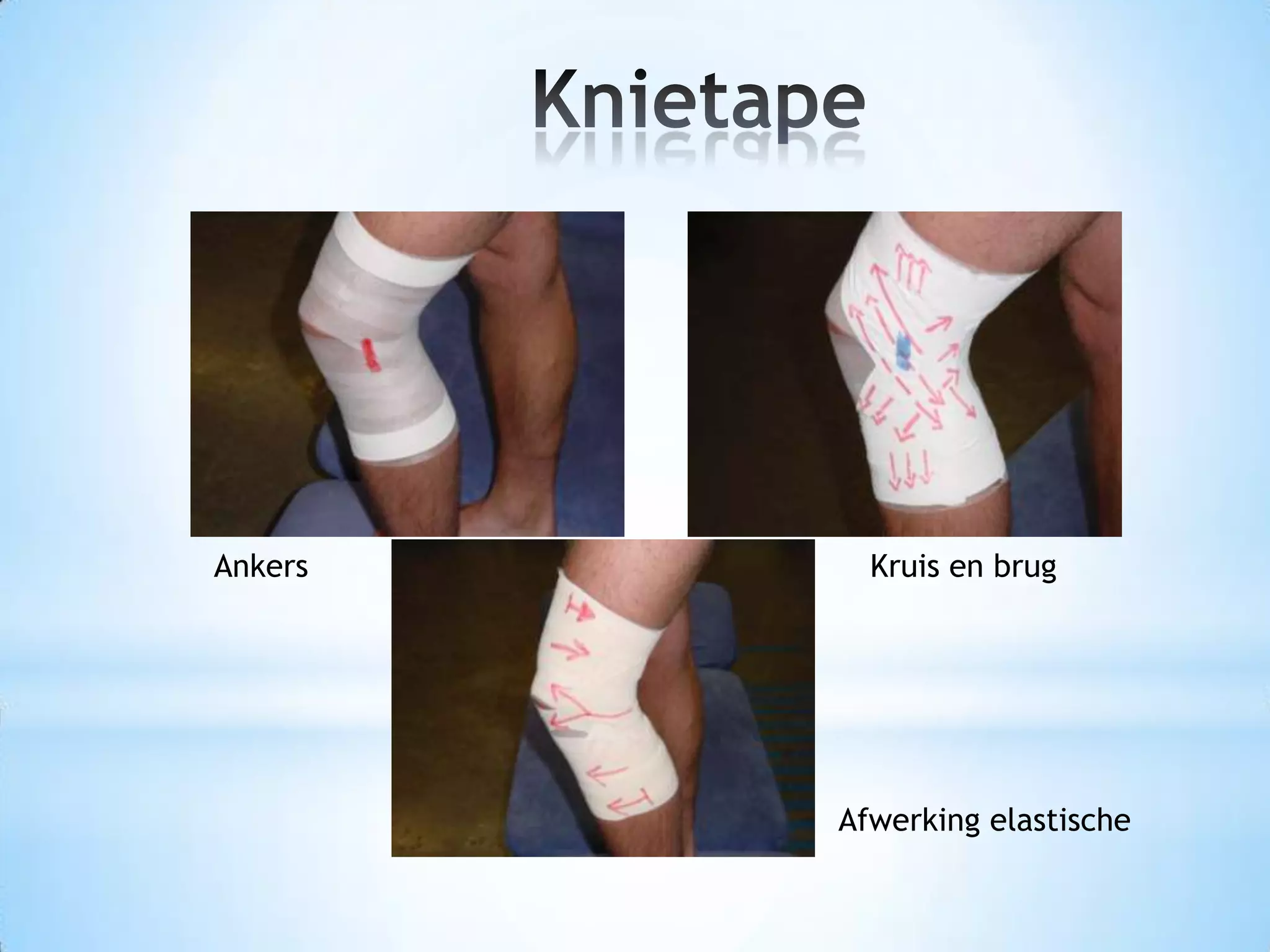 Basic principles of taping techniques - Mr. Marc Lievens | PPTX