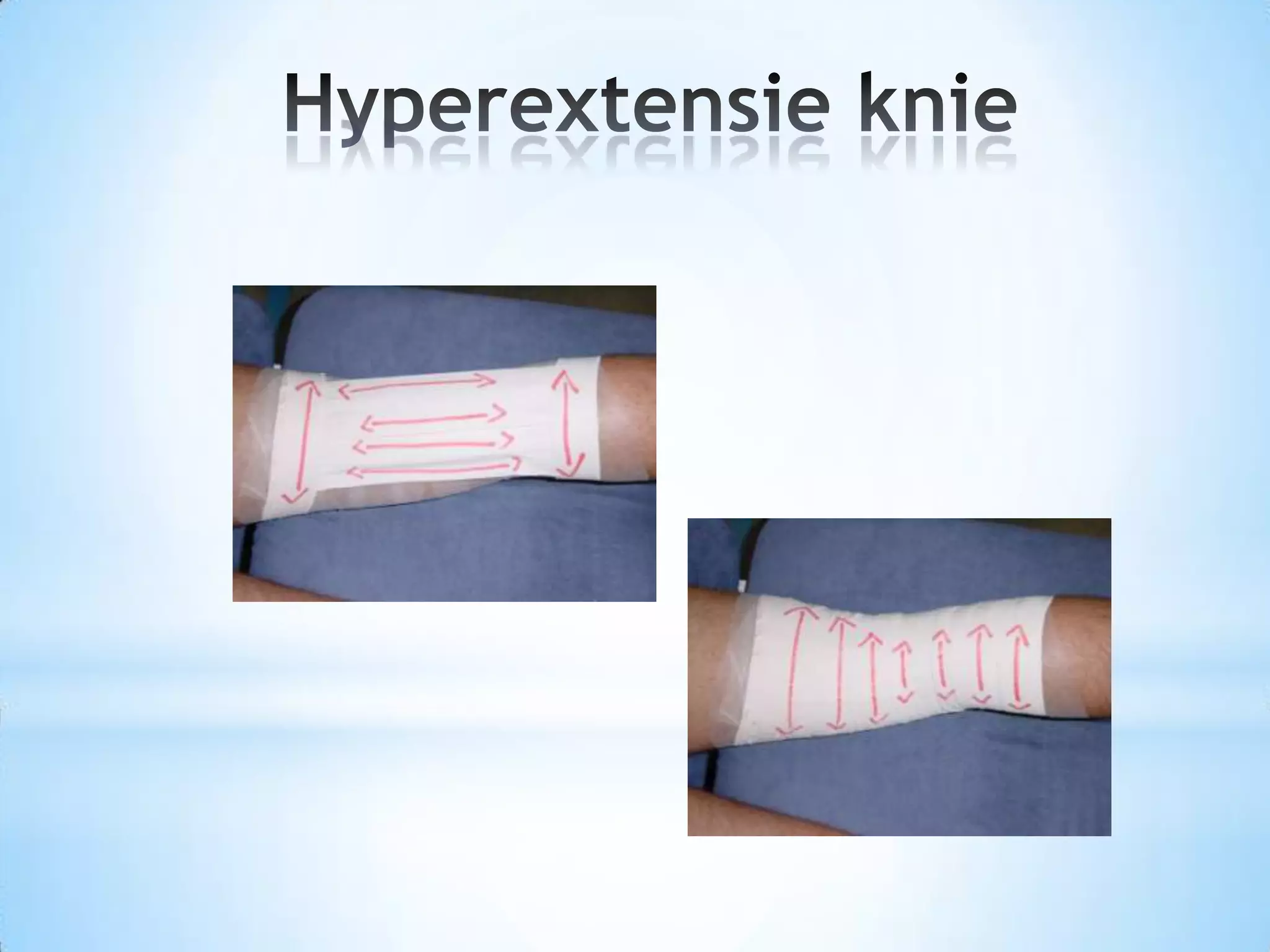 Basic principles of taping techniques - Mr. Marc Lievens | PPTX