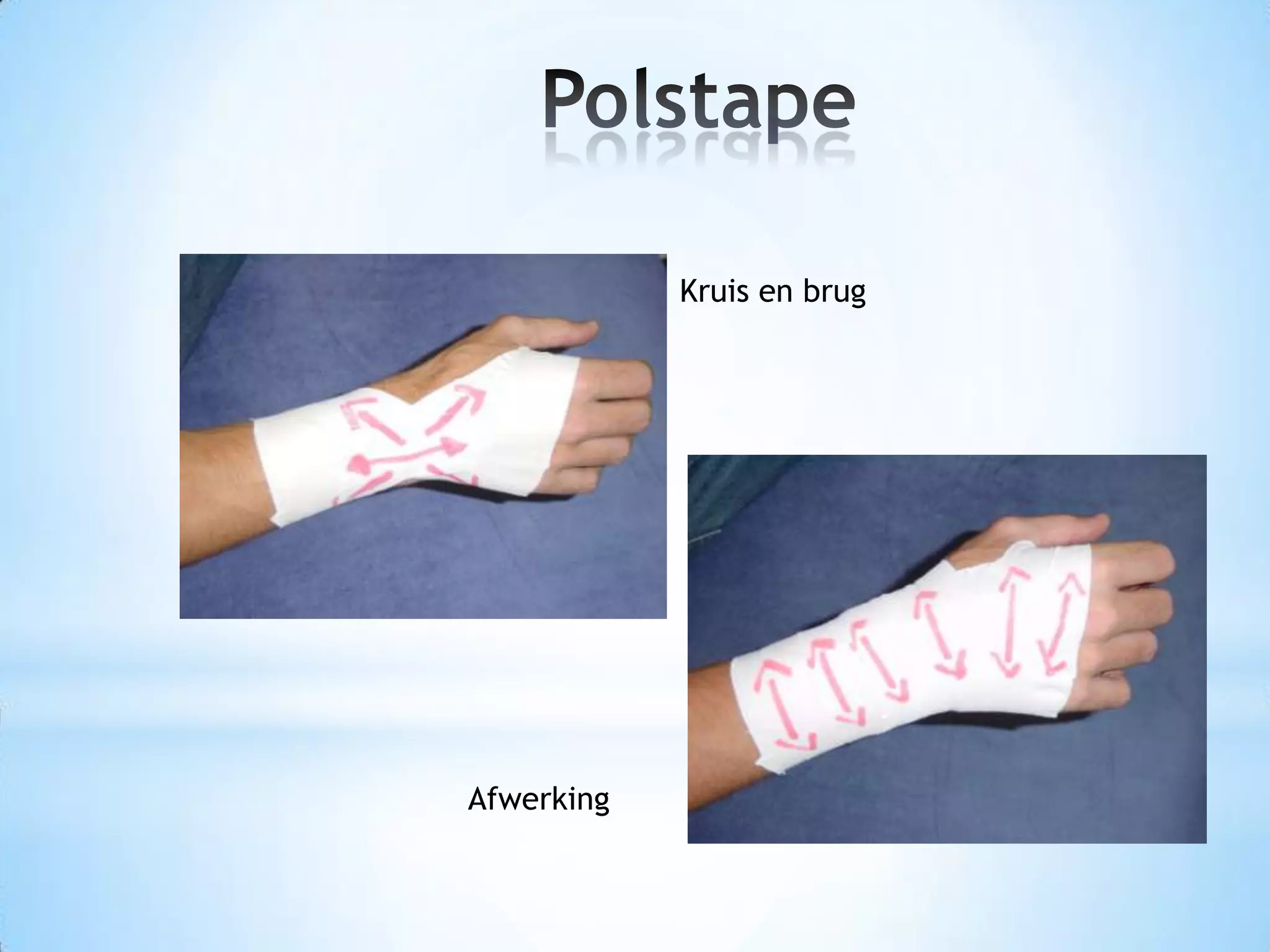 Basic principles of taping techniques - Mr. Marc Lievens | PPTX