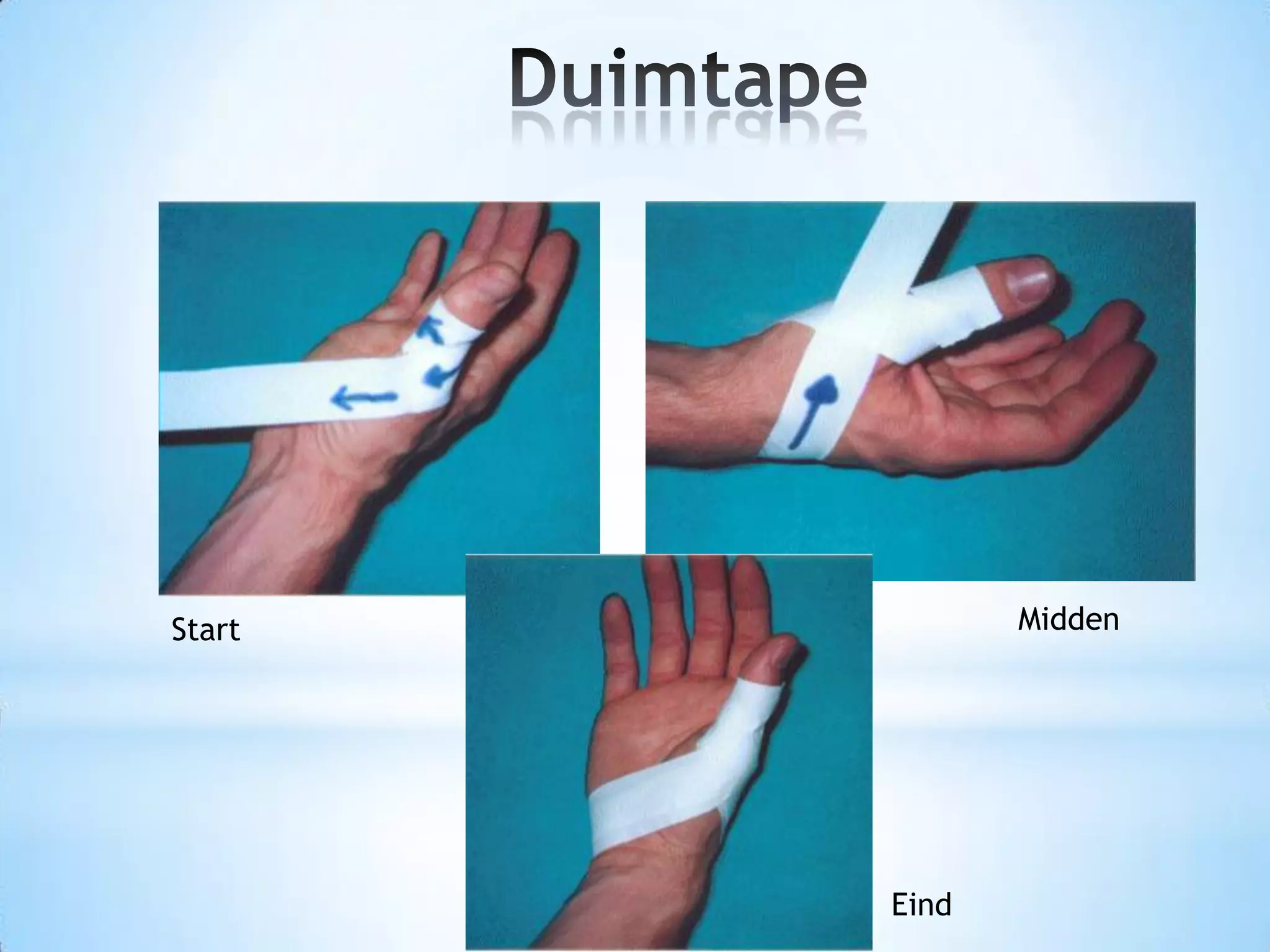 Basic principles of taping techniques - Mr. Marc Lievens | PPTX