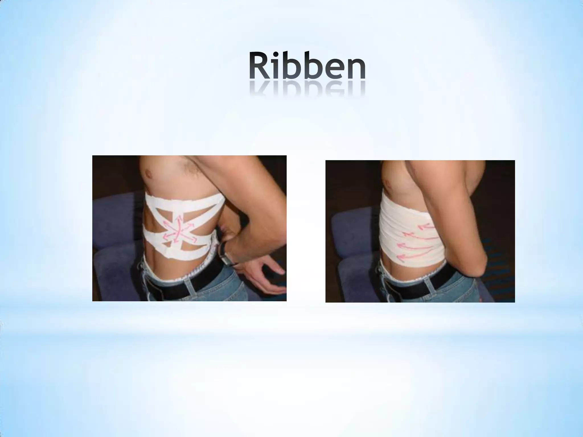 Basic principles of taping techniques - Mr. Marc Lievens | PPTX