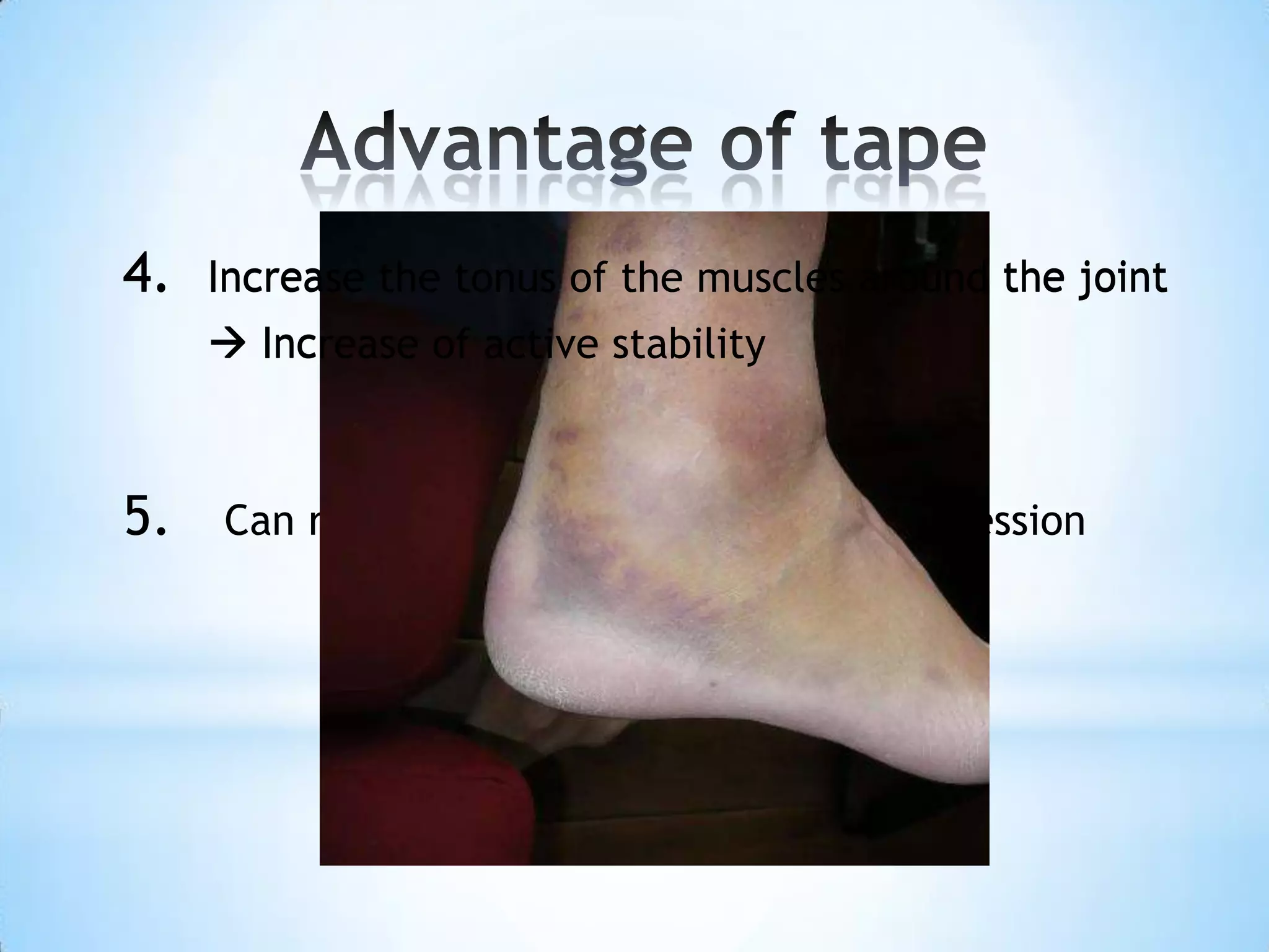 Basic principles of taping techniques - Mr. Marc Lievens | PPTX