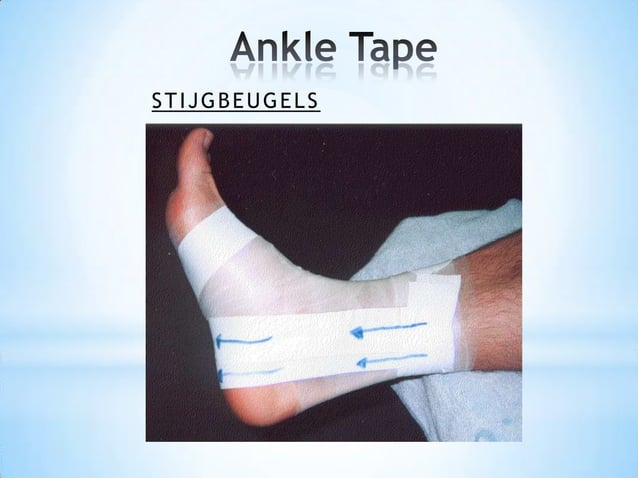 Basic principles of taping techniques - Mr. Marc Lievens | PPTX