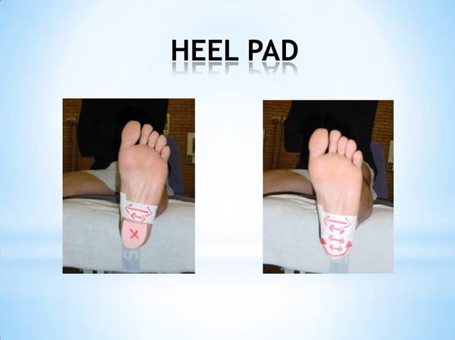 Basic principles of taping techniques - Mr. Marc Lievens | PPTX